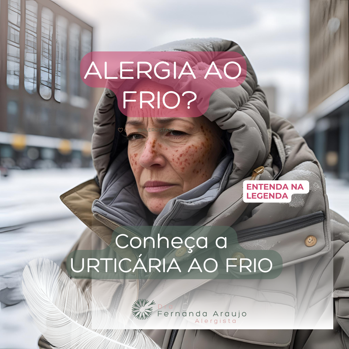 Alergia ao frio - Urticária ao Frio em São Paulo: Sintomas, Causas e ...